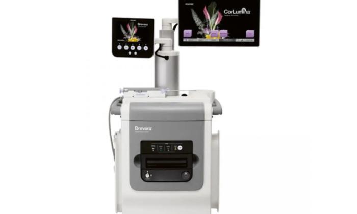Hologic launches AI powered imaging technology • healthcare-in-europe.com Hologic launches AI powered imaging technology • healthcare-in-europe.com