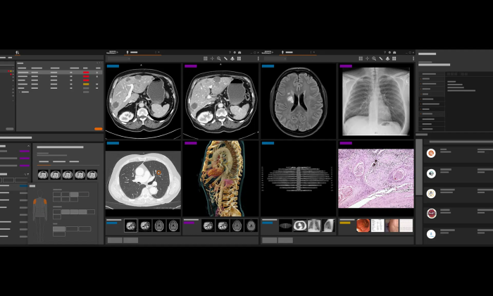 ARTIS icono ceiling • healthcare-in-europe.com