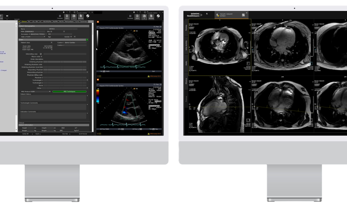 MAGNETOM Flow. Platform (70 cm)* • healthcare-in-europe.com