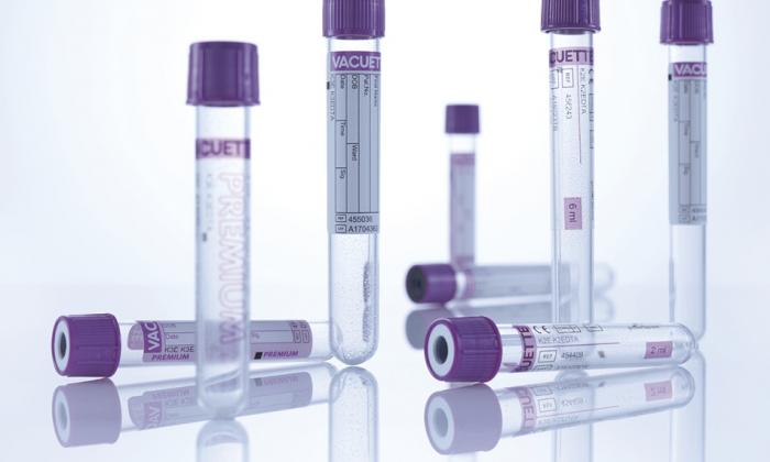 Vacuette Urine CCM Tube • healthcare-in-europe.com