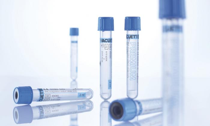 Vacuette CAT Serum Fast Tube • healthcare-in-europe.com