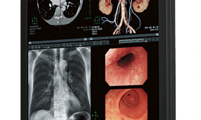 Modern anesthesia in the MR environment