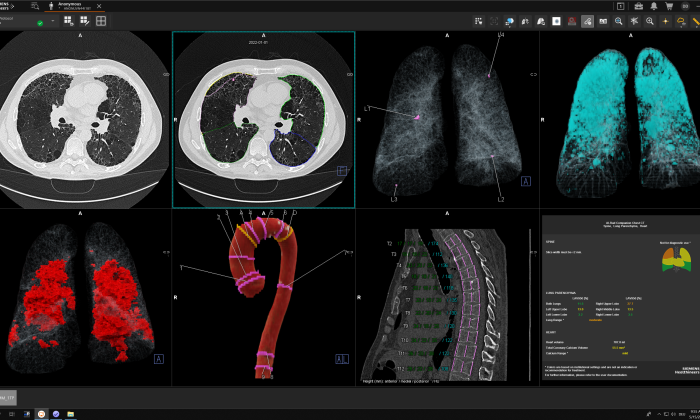 AI-Rad Companion • healthcare-in-europe.com
