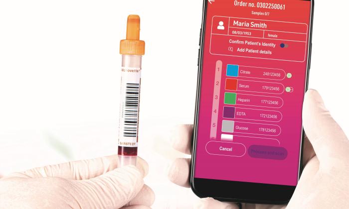 S-Monovette ThromboExact – Pseudothrombocytopenia • healthcare-in ...