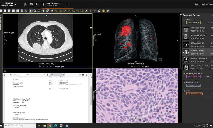 ARTIS icono ceiling • healthcare-in-europe.com