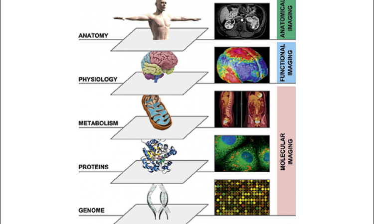 50 shades of grey in hybrid imaging • healthcare-in-europe.com