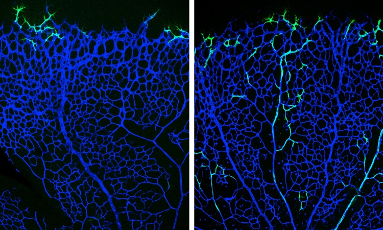 The key to growing new arteries • healthcare-in-europe.com