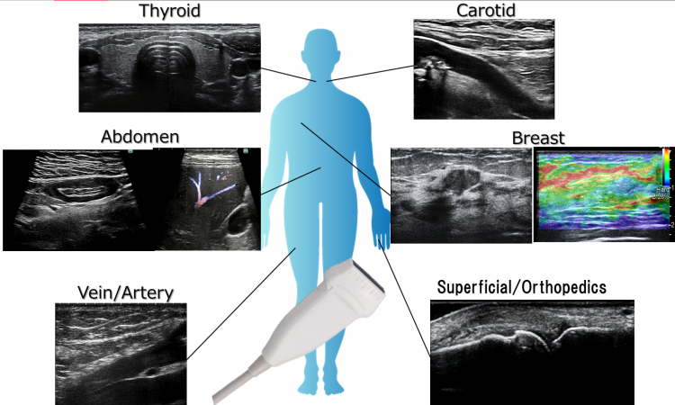 The multi-tasking 4G CMUT linear matrix probe • healthcare-in-europe.com