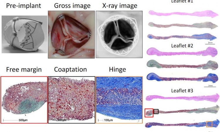 Renewing the promise of bioabsorbable implants • healthcare-in-europe.com