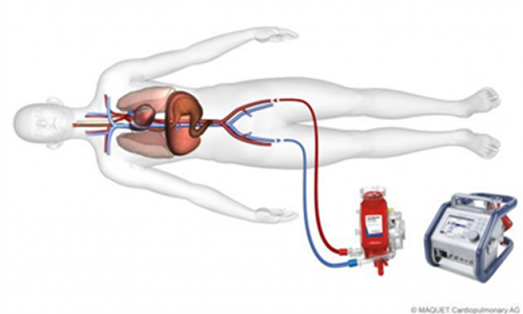 Mit ECMO ins CT • healthcare-in-europe.com
