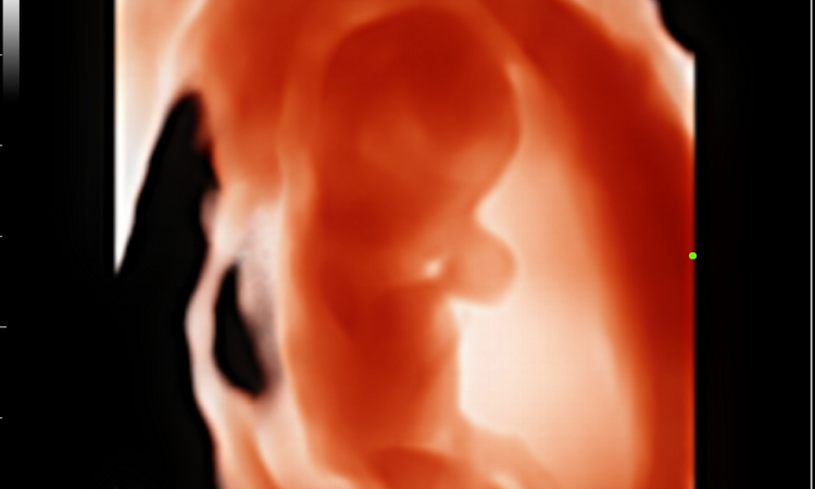 Fetalchirurgie: Alles für die Allerkleinsten • healthcare-in-europe.com