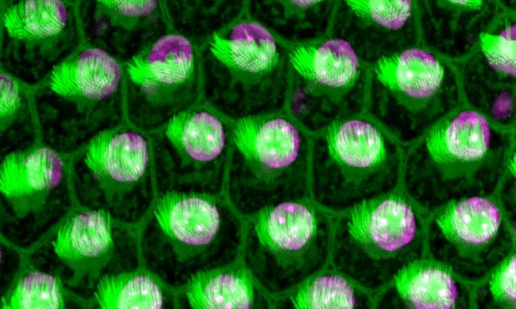 Inner ear stem cells may someday restore hearing • healthcare-in-europe.com