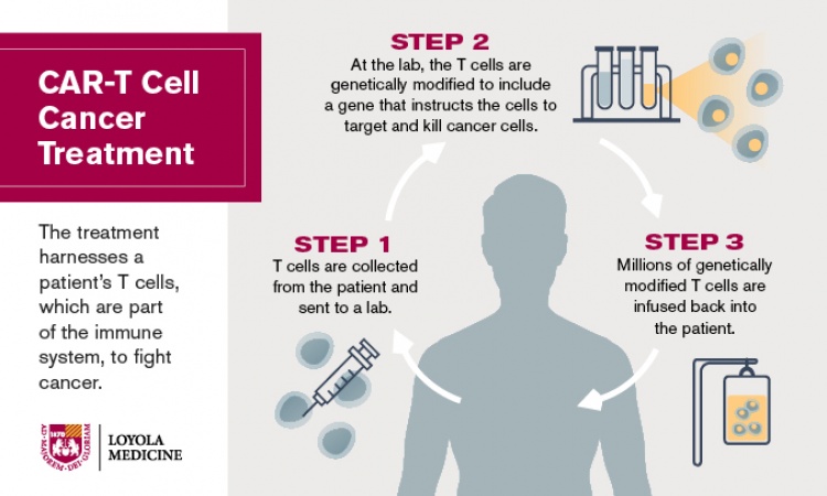 CAR-T: Landmark cancer study sheds new light on immunotherapy ...