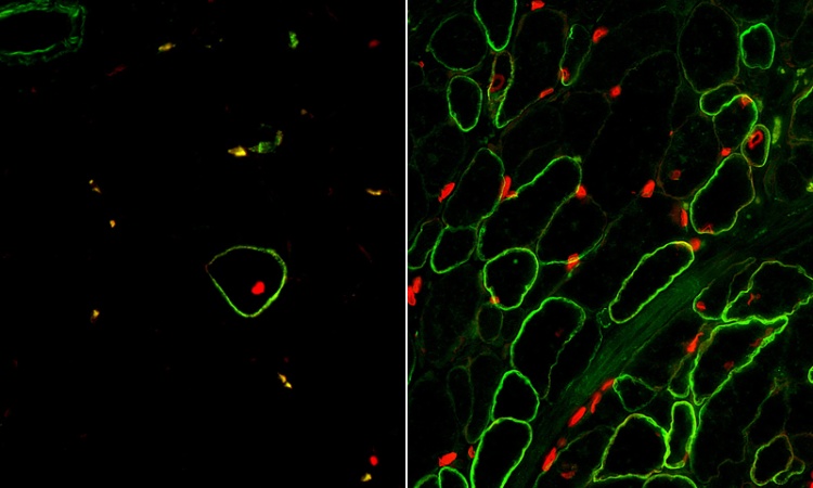 Researchers create skeletal muscle from stem cells • healthcare-in ...