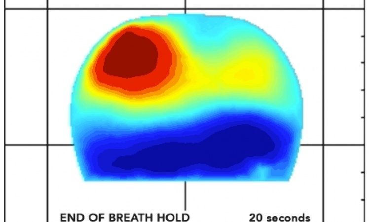 Breast cancer: Near-infrared light shows chemo beneficiaries ...