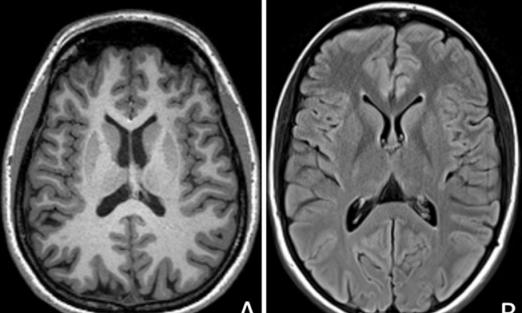 Population imaging: Big Data will boost disease prediction • healthcare ...