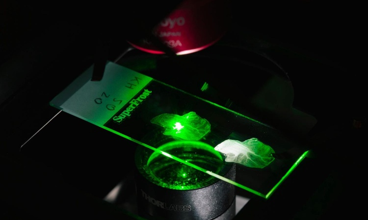 Progressing towards optical biopsy • healthcare-in-europe.com