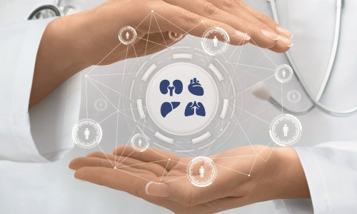 Xenios and Fresenius Medical Care take the next step to multi-organ ...