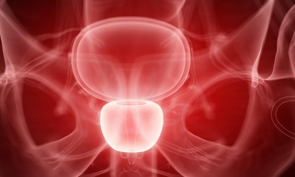 Prostate cancer: Combination of radiation therapies key to success ...
