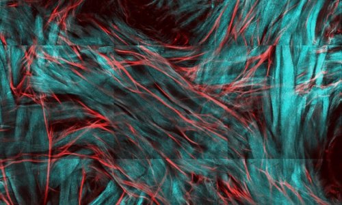 Seeing the pattern beneath the skin • healthcare-in-europe.com