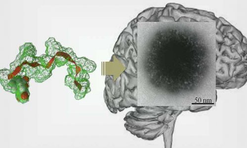Overcoming the blood-brain-barrier: Delivering therapeutics to brain ...