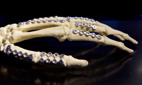 New insights on the corrosion of metal implants • healthcare-in-europe.com