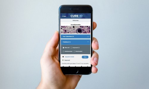 Cure ID: App finds new ways of treatment • healthcare-in-europe.com