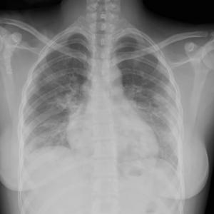 Insight on the use of CMR in COVID-19 patients • healthcare-in-europe.com