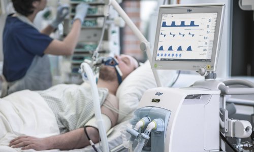 Rechtzeitige Intubation kann Leben retten • healthcare-in-europe.com