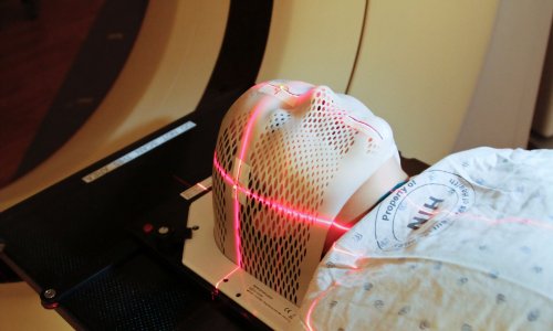 Improving image quality of CT scans • healthcare-in-europe.com