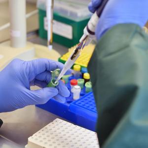 SARS-CoV-2: Labore bewältigen Ausweitung der Teststrategie • healthcare ... SARS-CoV-2: Labore bewältigen Ausweitung der Teststrategie • healthcare ...