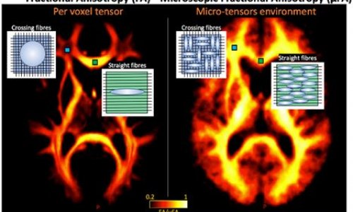 Software finds white matter damage in brain tissue • healthcare-in ...