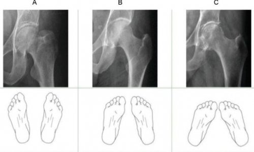 Radiography: Correct patient positioning is critical • healthcare-in ...