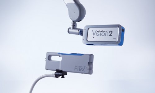 VeinViewer® - Innovation in visualization • healthcare-in-europe.com