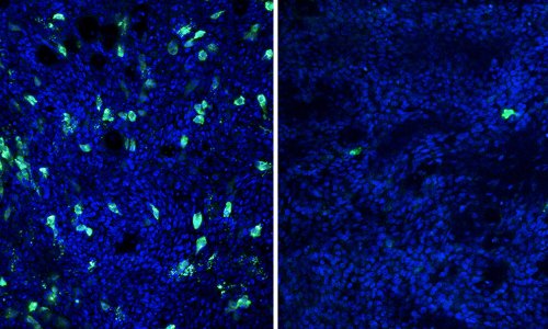 Common cold combats influenza • healthcare-in-europe.com