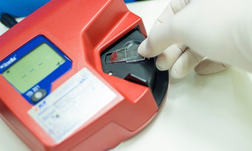 The clinical potential of POCT • healthcare-in-europe.com