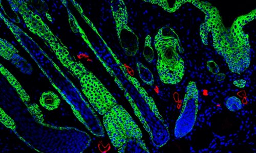 Wound-healing hydrogel to improve skin tissue repair • healthcare-in ...