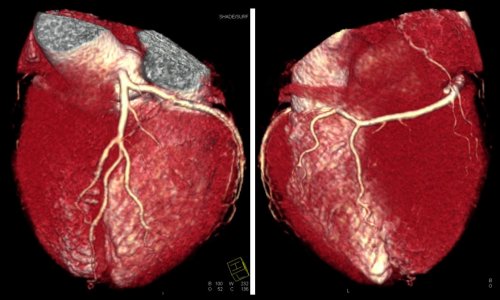Cardiac CT: a diagnostic jack-of-all-trades • healthcare-in-europe.com
