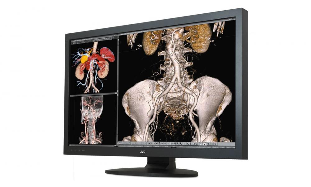 Evolving breast imaging with MARIA™ • healthcare-in-europe.com