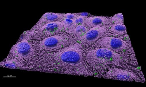 How nanoplastics threaten human health • healthcare-in-europe.com