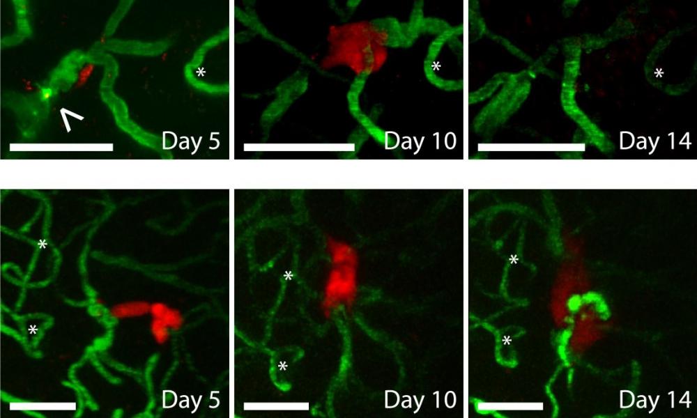 Koagulation • healthcare-in-europe.com