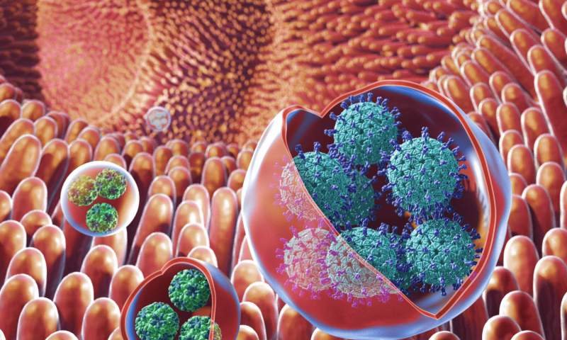 Bacteria die on stainless steel • healthcare-in-europe.com