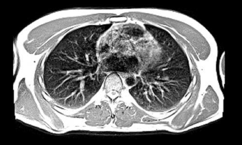 Low-field MRI: Less is more • healthcare-in-europe.com