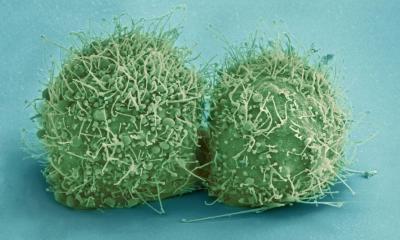 World's first digital cancer cell model • healthcare-in-europe.com