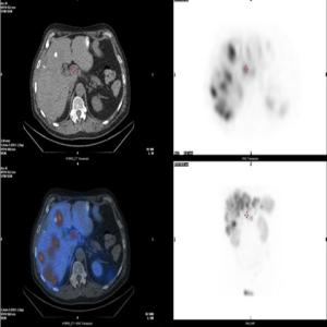 A laser-powered upgrade to cancer treatment • healthcare-in-europe.com