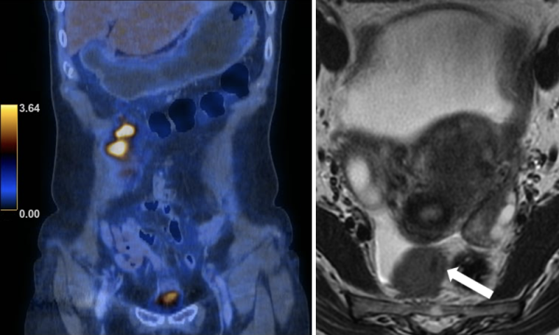 Hybrid Imaging: today and tomorrow • healthcare-in-europe.com