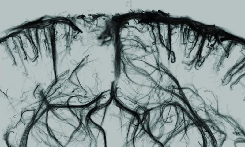 New 3D imaging technique to diagnose peripheral vascular diseases ...