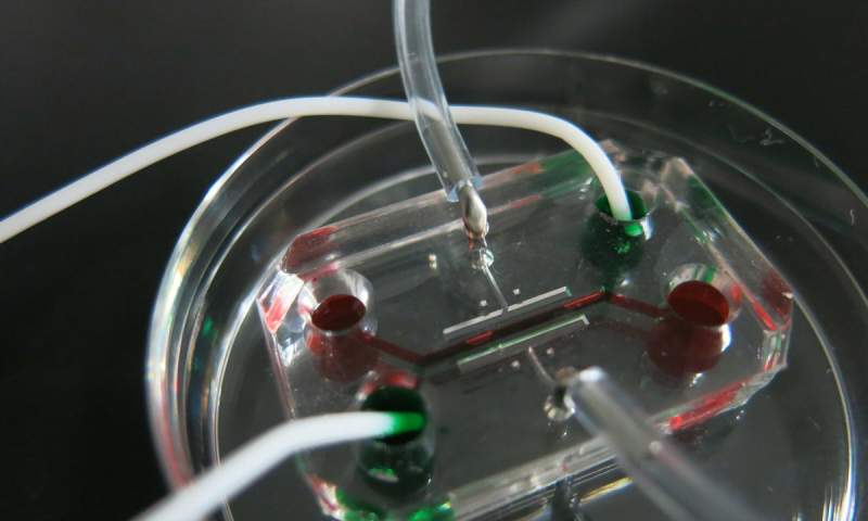 Automated plate streaking • healthcare-in-europe.com