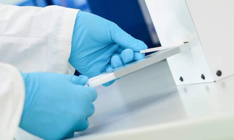 New test with simplified preanalytics for simultaneous detection of GDH ...