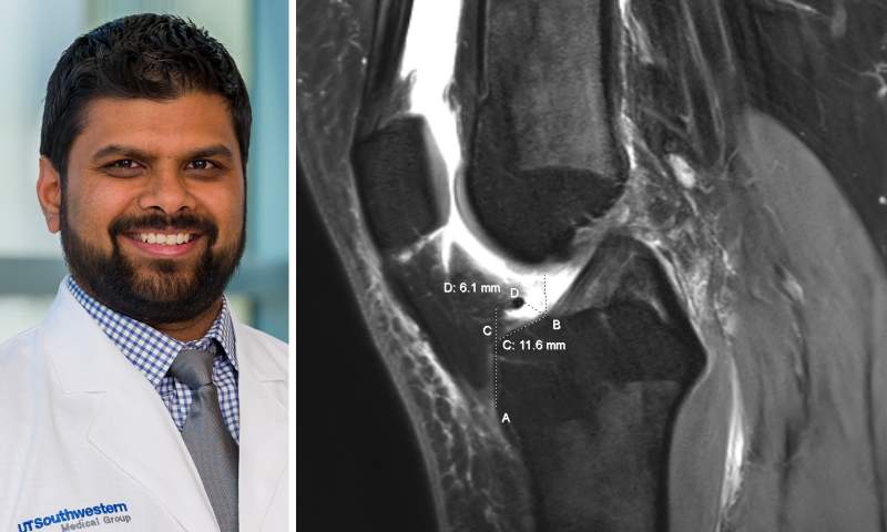 Breast cancer: ultrafast MRI shows promise • healthcare-in-europe.com